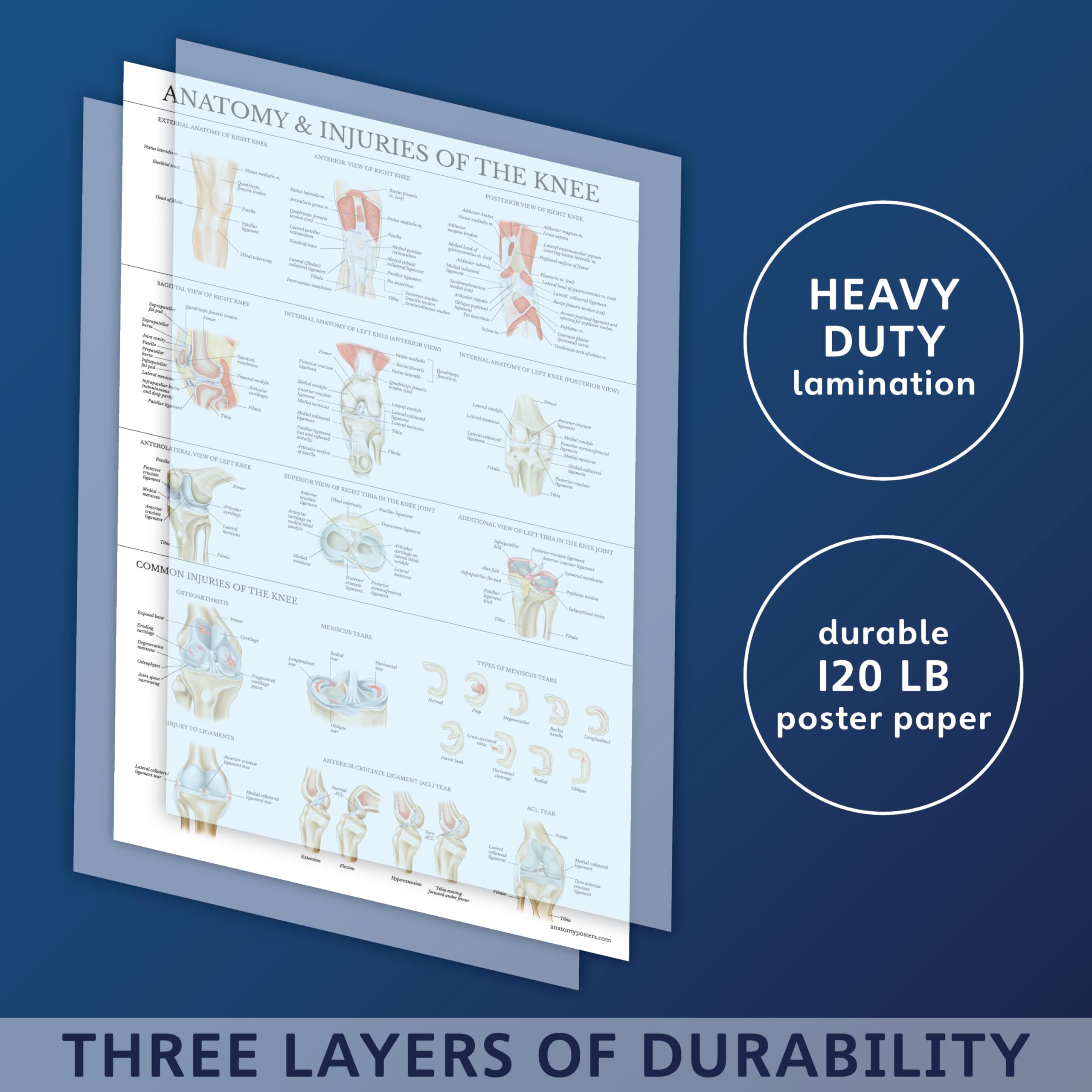 Palace Learning 2 Pack - Anatomy and Injuries of The Knee & Shoulder Poster Set - Anatomical Chart Set - Laminated 18" x 24"