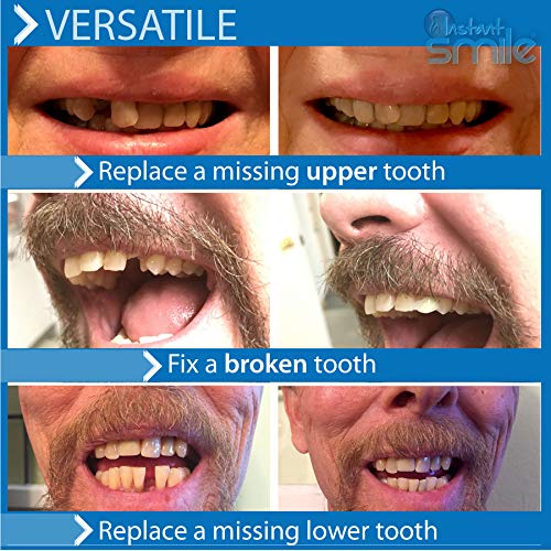 Instant Smile Temporary Tooth Kit -Pro-Series