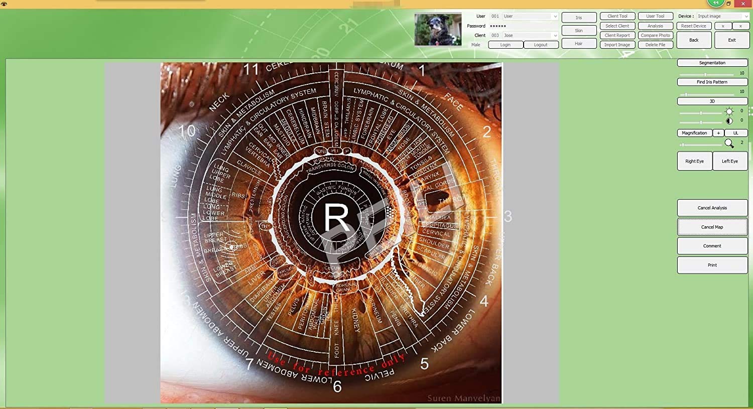 Iriscope Iridology Camera 5.0 MP LED Light Iris Analyser Iridoscope iriscopio