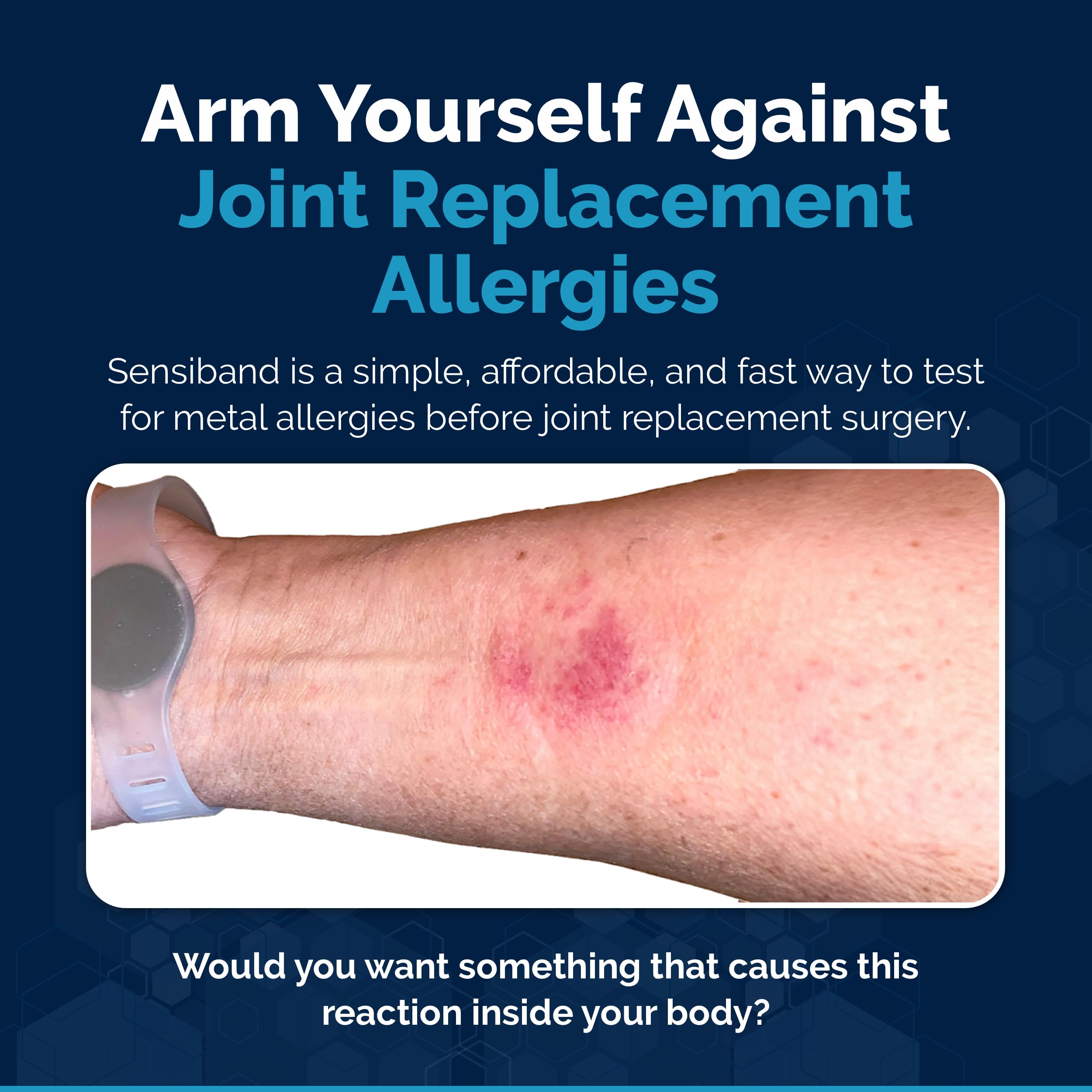 SENSIBAND Metal Allergy Test Band β Test at Home or Anywhere - Tests for Common Metals Used in Piercings & Jewelry - See Your Own Results - Order 3 Weeks Before Surgery.β¦ (Copper)