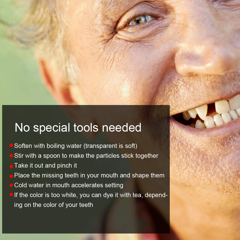 Tooth Repair Bead, Broken Teeth Repair, Multi Functional Temporary Tooth Repair Kit Moldable Thermal Fitting Beads Dental Tooth Filling Material for Snap On Instant and Confident