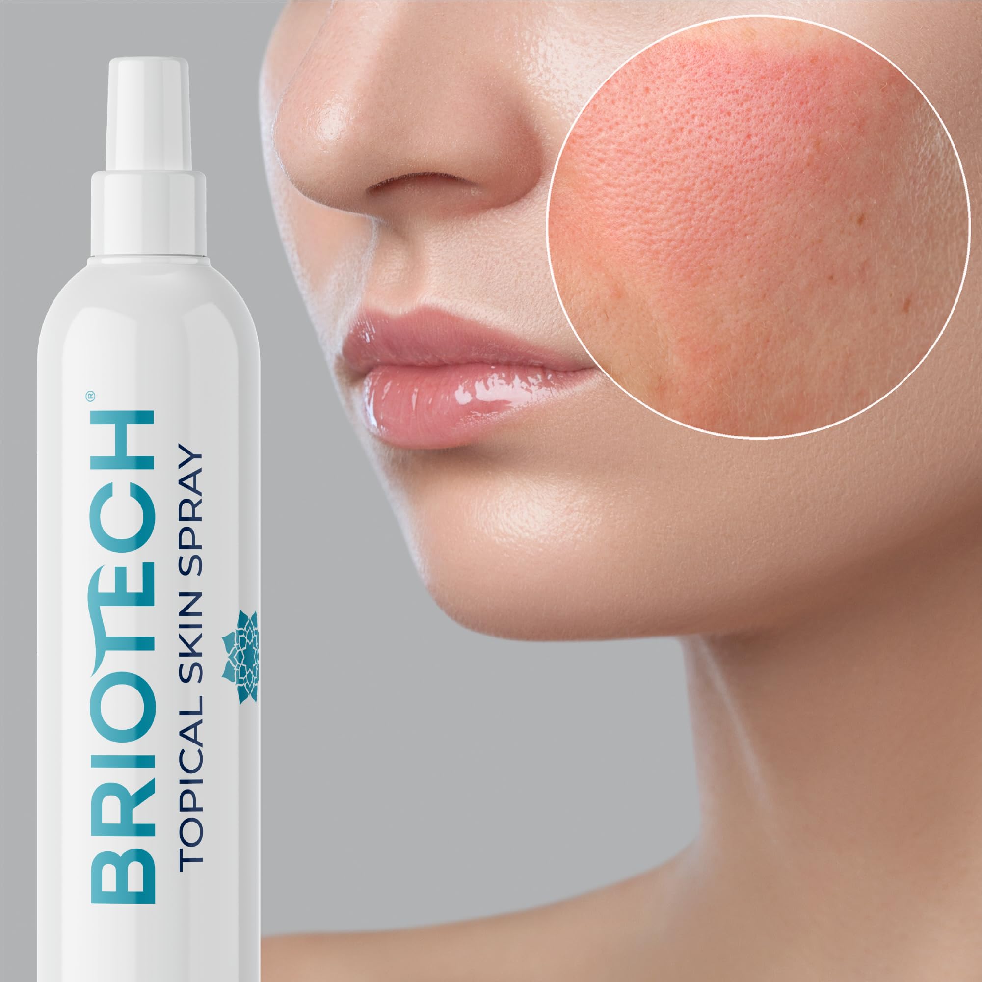 BRIOTECH Topical Skin Spray, Hypochlorous Acid Spray for Body & Face, Eyelid Cleanser, HOCl Facial Mist, Support Against Irritation and Redness, Stocking Stuffers, Packaging May Vary, 4 oz, 1 ct