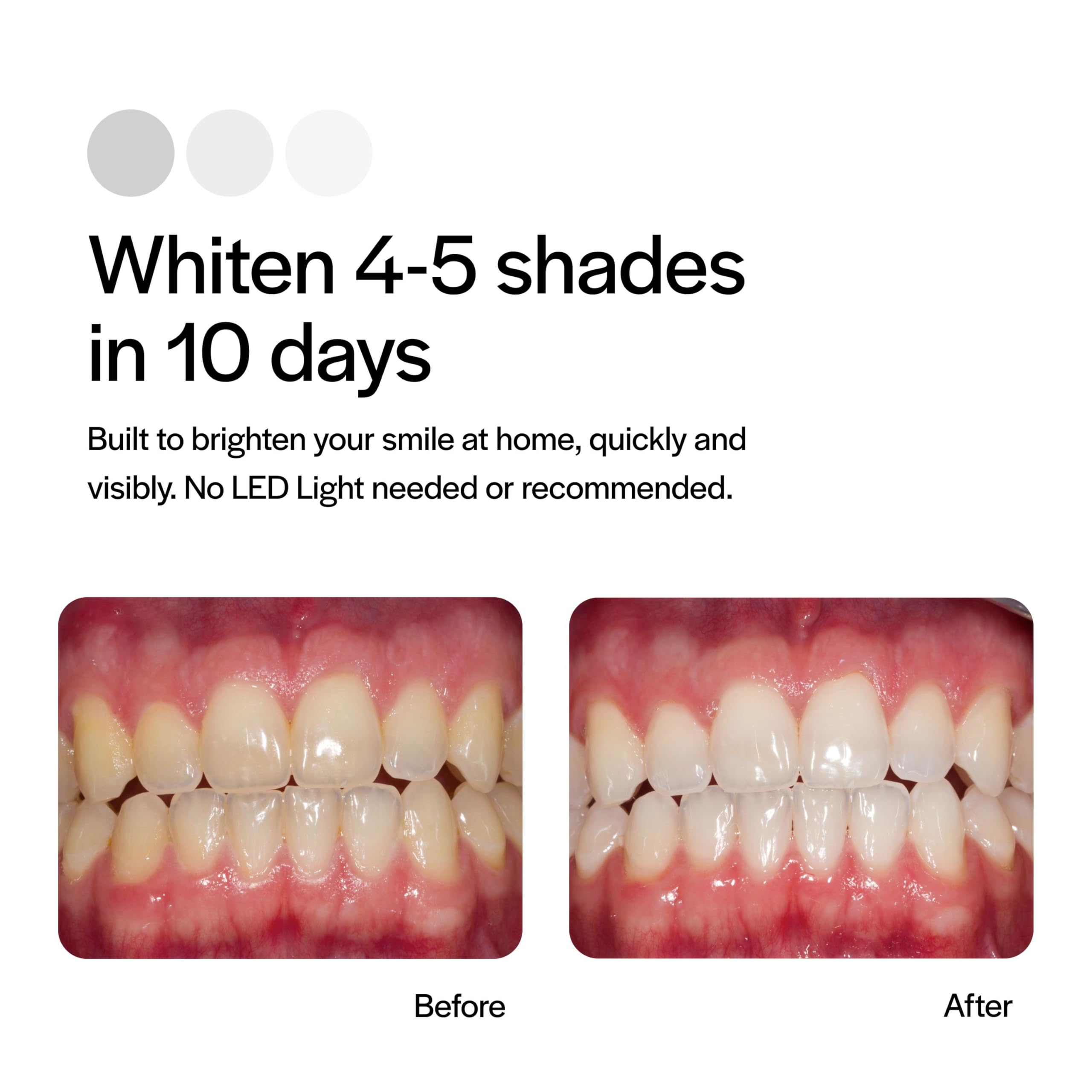 Opalescence Go - Prefilled Teeth Whitening Trays - Original 15% - (4 Treatments) - Hydrogen Peroxide with PF - Cool Mint - Made by Ultradent. 4648-1