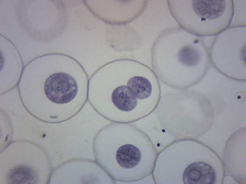 EISCO Ascaris & Onion Mitosis, Prepared Microscope Slide - 75 x 25mm - Plant & Animal Mitosis, Introductory Microscopy