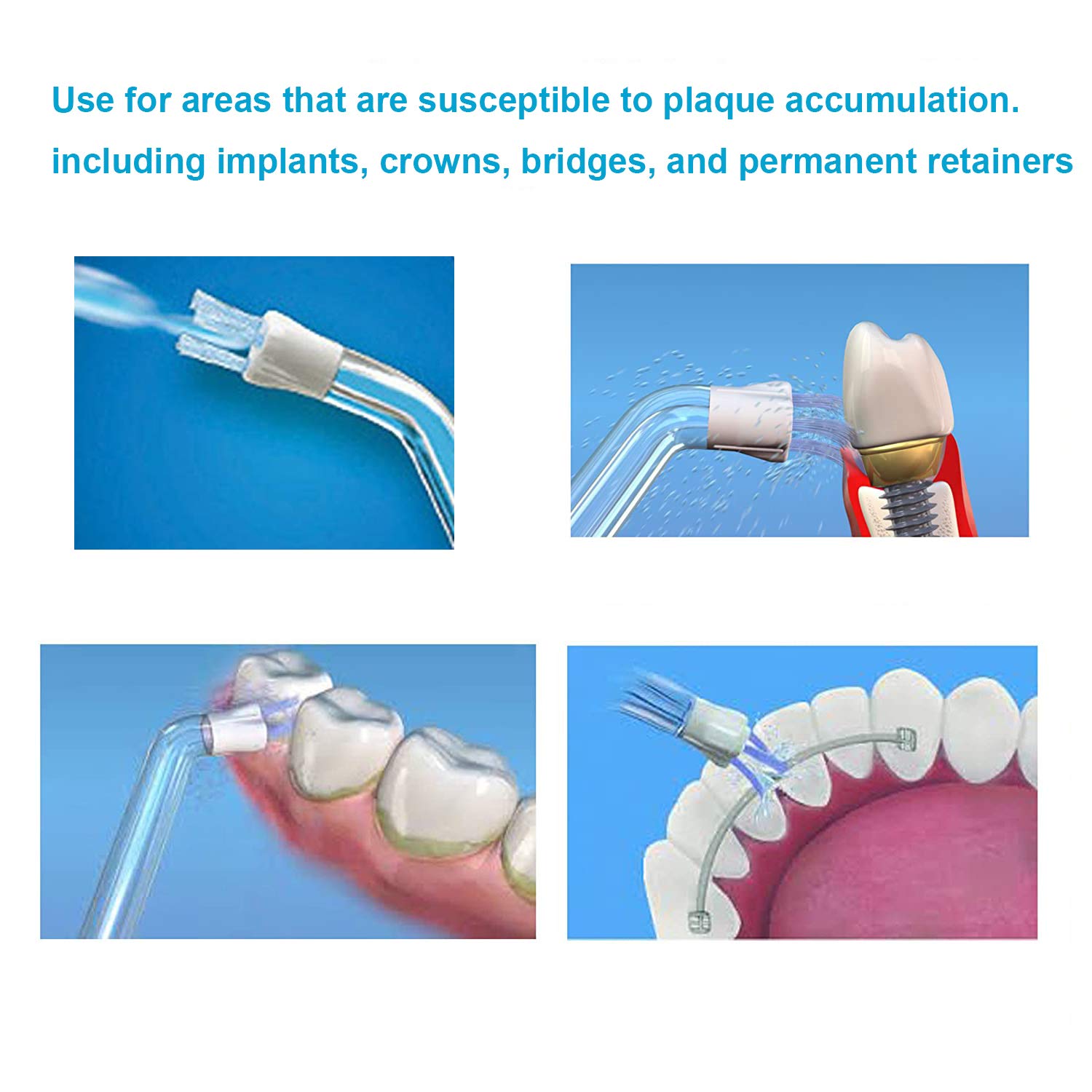 Plaque Seeker Replacement Tips Compatible with Waterpik Water Flossers and Other Brand Oral Irrigators, Water Flosser Tip Replacement, Plaque Remove Brisles Tips(4-Pack)