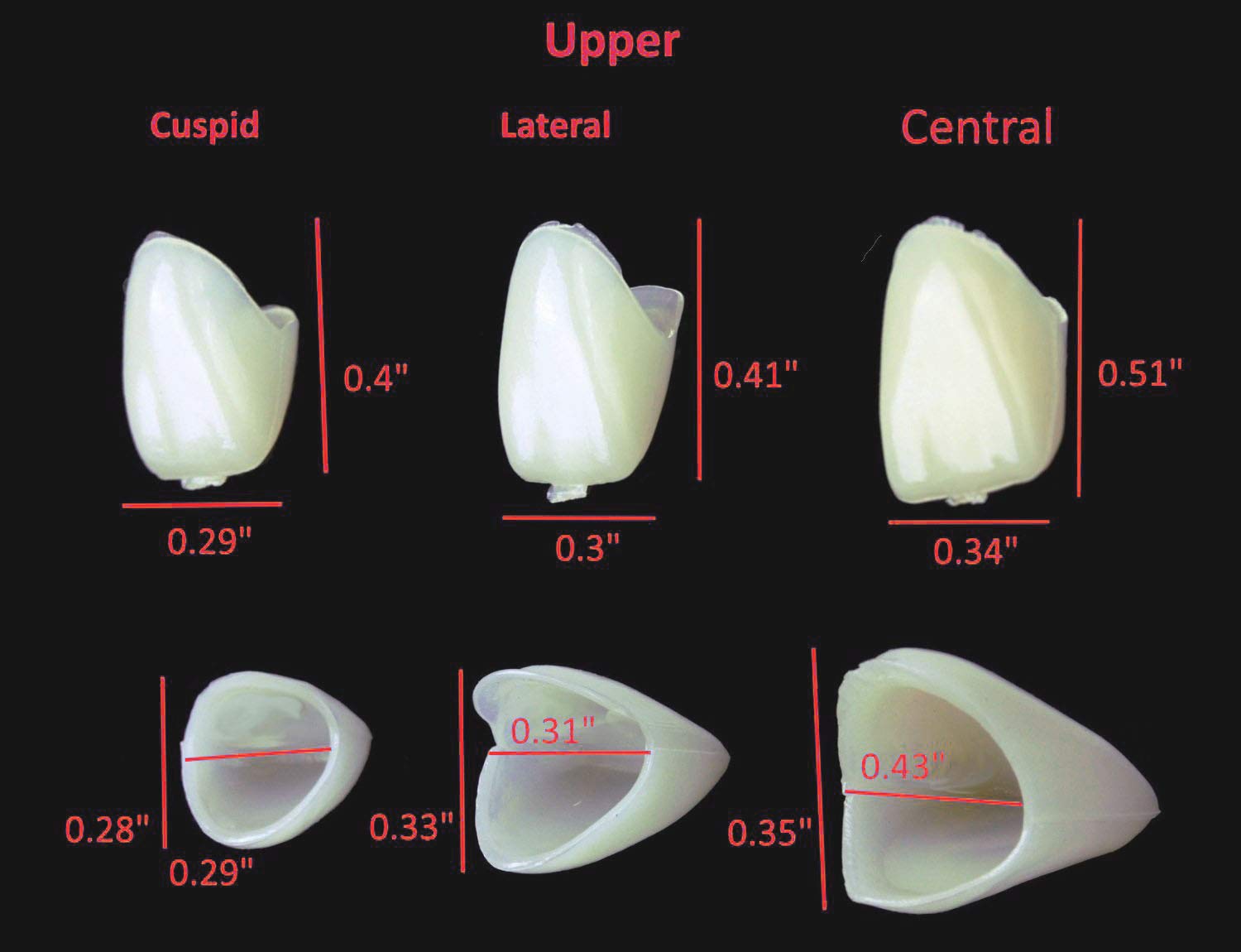 Temporary Tooth Crown Fake Teeth Repair Material Front & Molar Posterior offering Help in Fixing Missing Broken Tooth (2 boxes around 100 pcs)