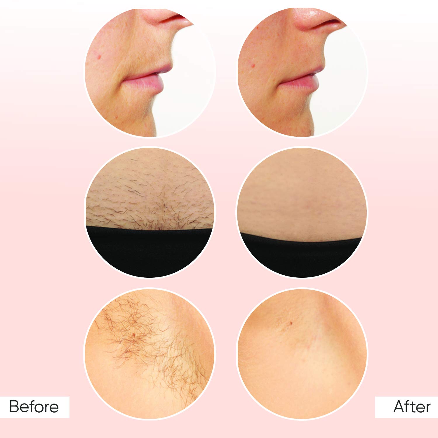Sensica Sensilight Mini Permanent Hair Removal Device for Men & Women, Advanced RPL Technology System Painless Kit, Hairless Body, Face & Skin