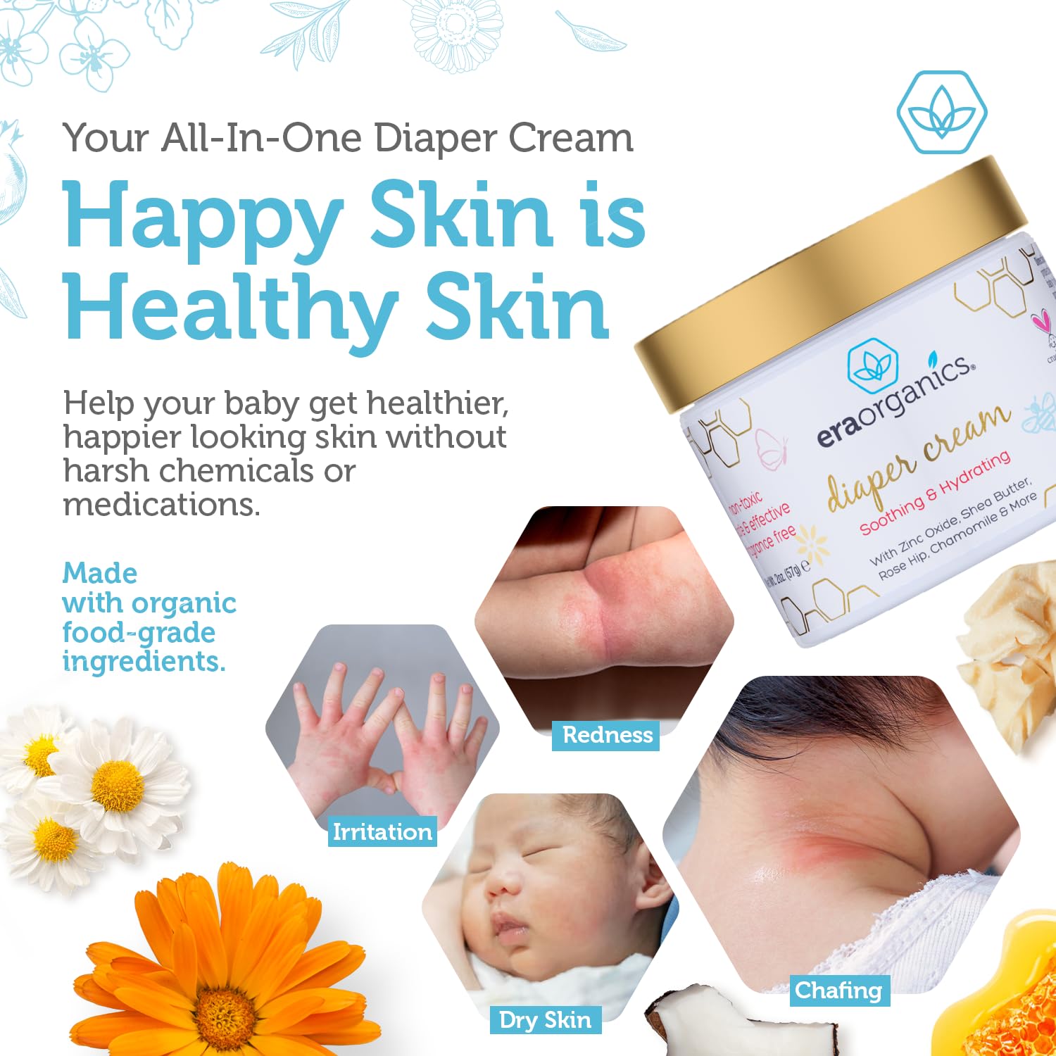 Era Organics Diaper Rash Cream For Baby - Extra Soothing and Moisturizing with Zinc Oxide, Organic Aloe Vera, Chamomile, Calendula Plus More - Gentle Butt Rash Moisturizer