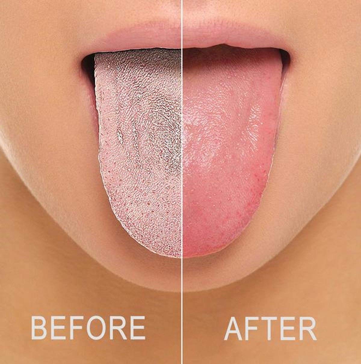 SUAVEC Liphontcta 4pc Random Colors Tongue Cleaner - Easy Grip Dual Head Tongue Scraper & Brush
