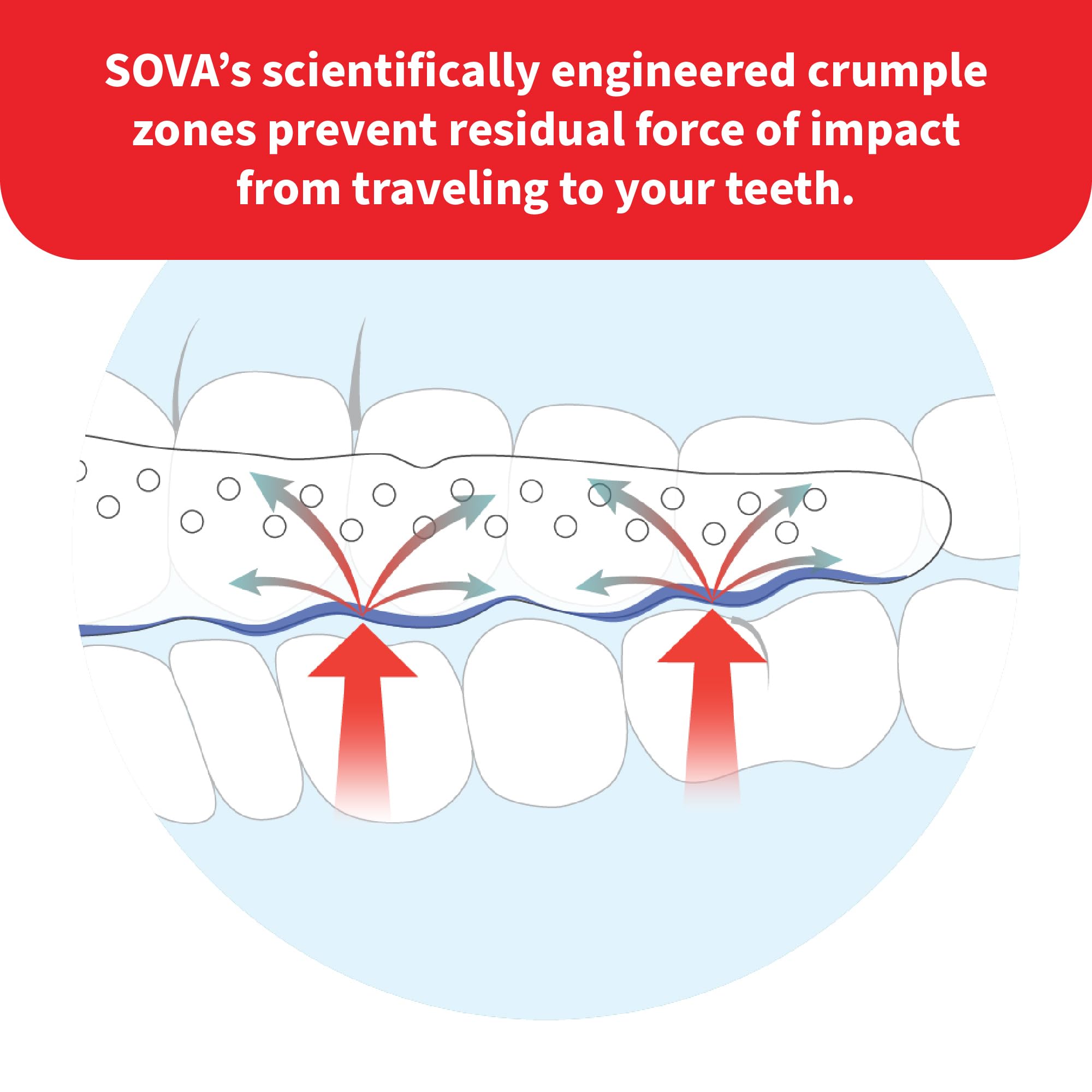 SOVA Max Night Guard - 2.4mm Thin - Custom-Molded Fit - Protects Against Nighttime Teeth Grinding & Clenching - FSA/HSA Eligible - Odor & Taste Free - Remoldable Up to 20 Times - Non Toxic