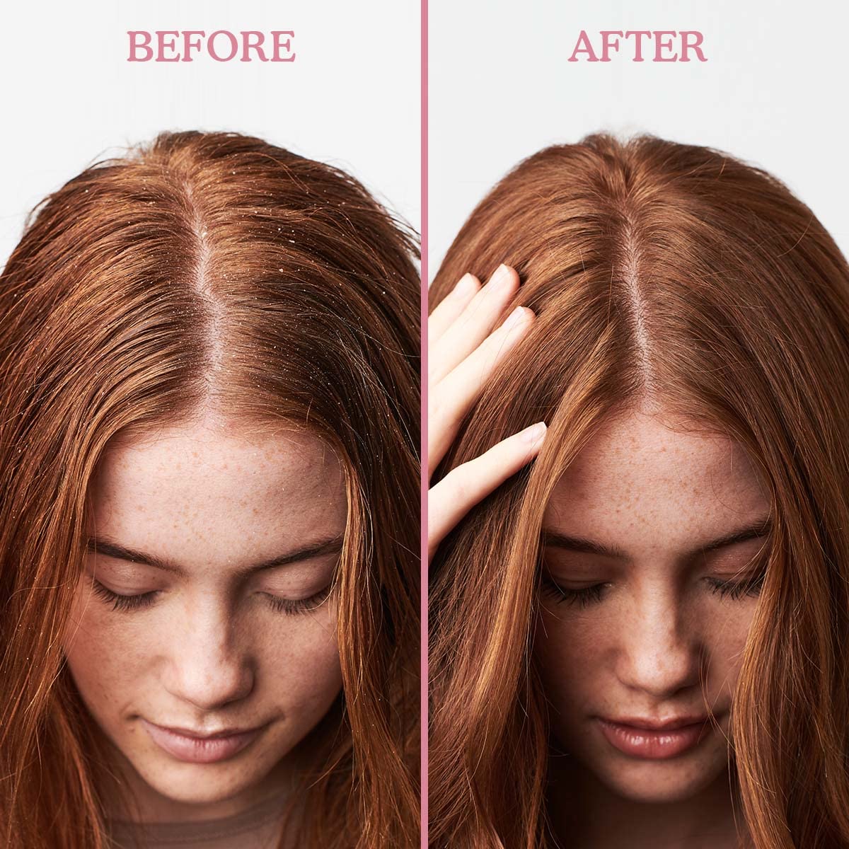 Umberto Giannini Scalp Restore Balancing Shampoo, Vegan & Cruelty Free Scalp Reviving Formula with Super Fruit Enzymes, 8.5fl Oz