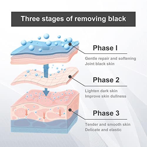 30ml Dark Spot Corrector,Dark Spot Remover For Body Serum Formulated,Skin Whitening Liquid,Brightening Dark Spots Removal Body Bleaching,Improves Hyperpigmentation