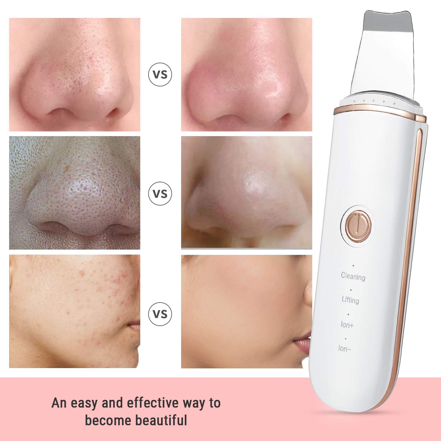 Skin Scrubber, Skin Spatula, Pores Cleanser Exfoliator Blackhead Remover Comedones Extractor for Facial Deep Cleansing with 4 Modes Include 4 Pcs Acne Reml Tool