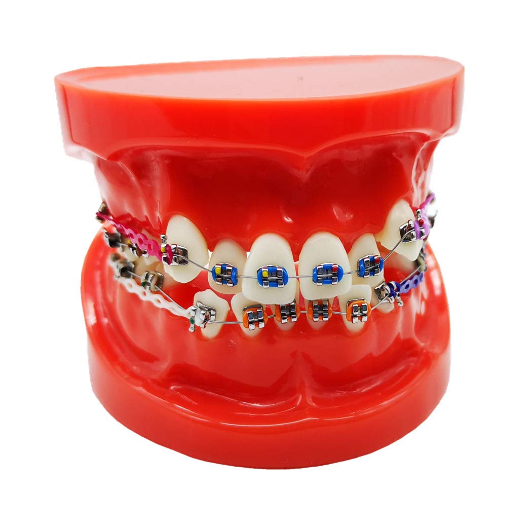 Dental Typodont With Metal Brackets Orthodontic Teeth Model With Ligature Ties Red