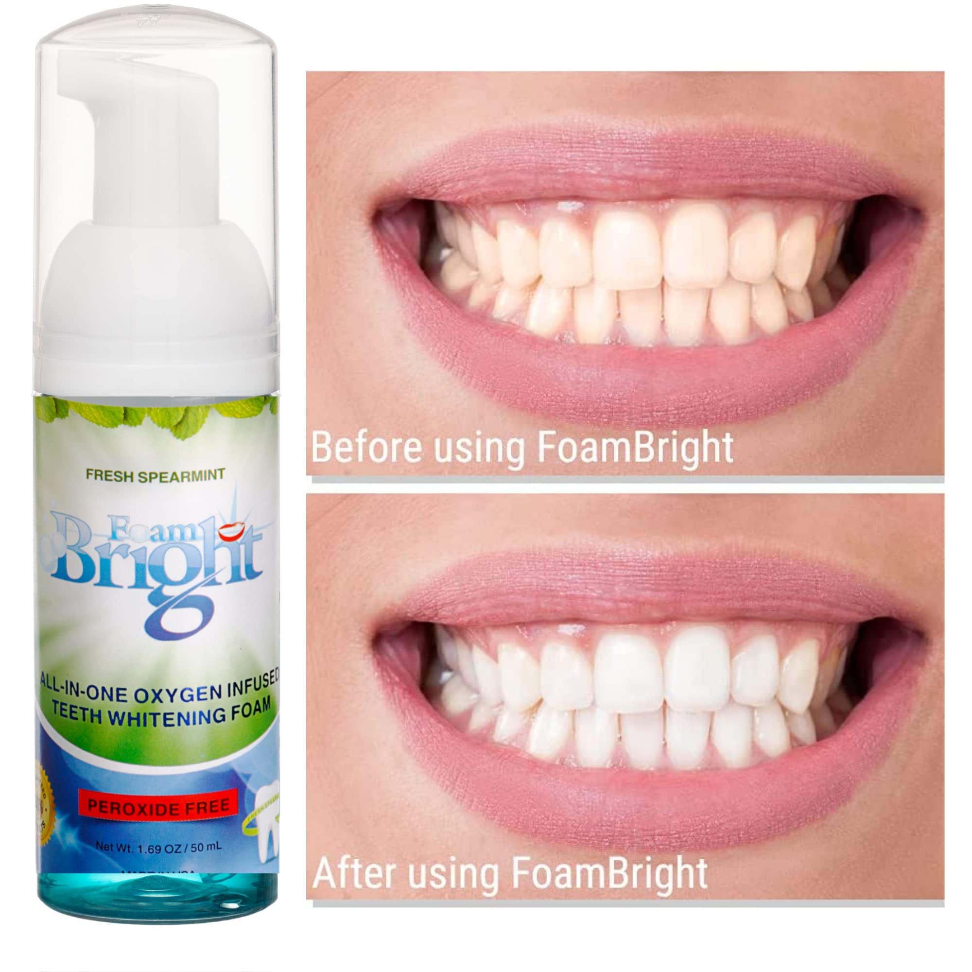 Retainer Foam Cleaner & Teeth Whitening Formula. The Ultimate Cleaning Toothpaste for Aligner Retainers. Great for All Kinds of Clear Retainers, Braces & Aligners. Safe for Dentures. (3 Pack)