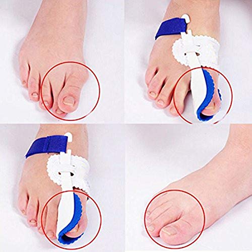 AnHua Valgus Bunion Corrector Orthotics Feet Bone Thumb Adjuster Correction Pedicure Sock Straightener Bunion Splint for Bunions For Crooked Toes Alignment Pain Relief (Style2:Blue white)