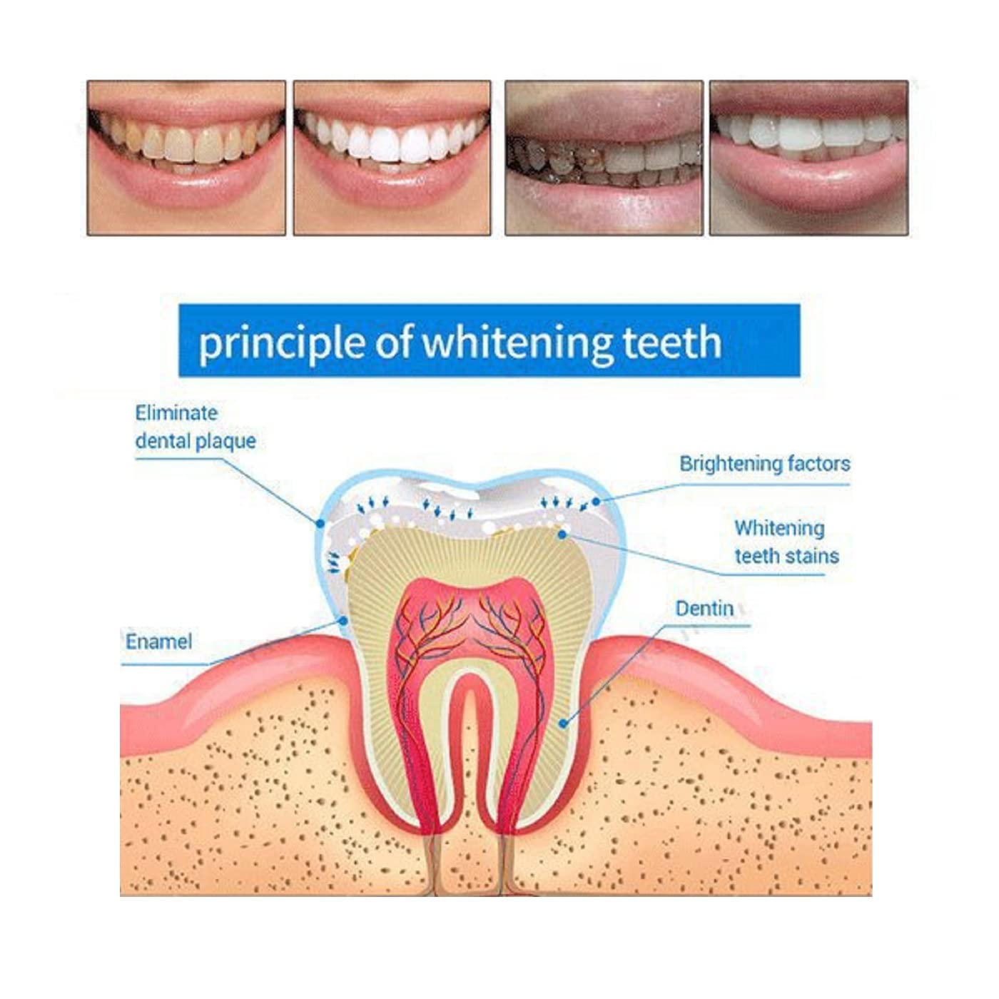 3Pcs Teeth Whitening Pen,Teeth Whitening Gel,Teeth Whitening Essence Pen,Intensive Teeth Stain Remover,Reduce Yellowing Oral Care for Women & Men.