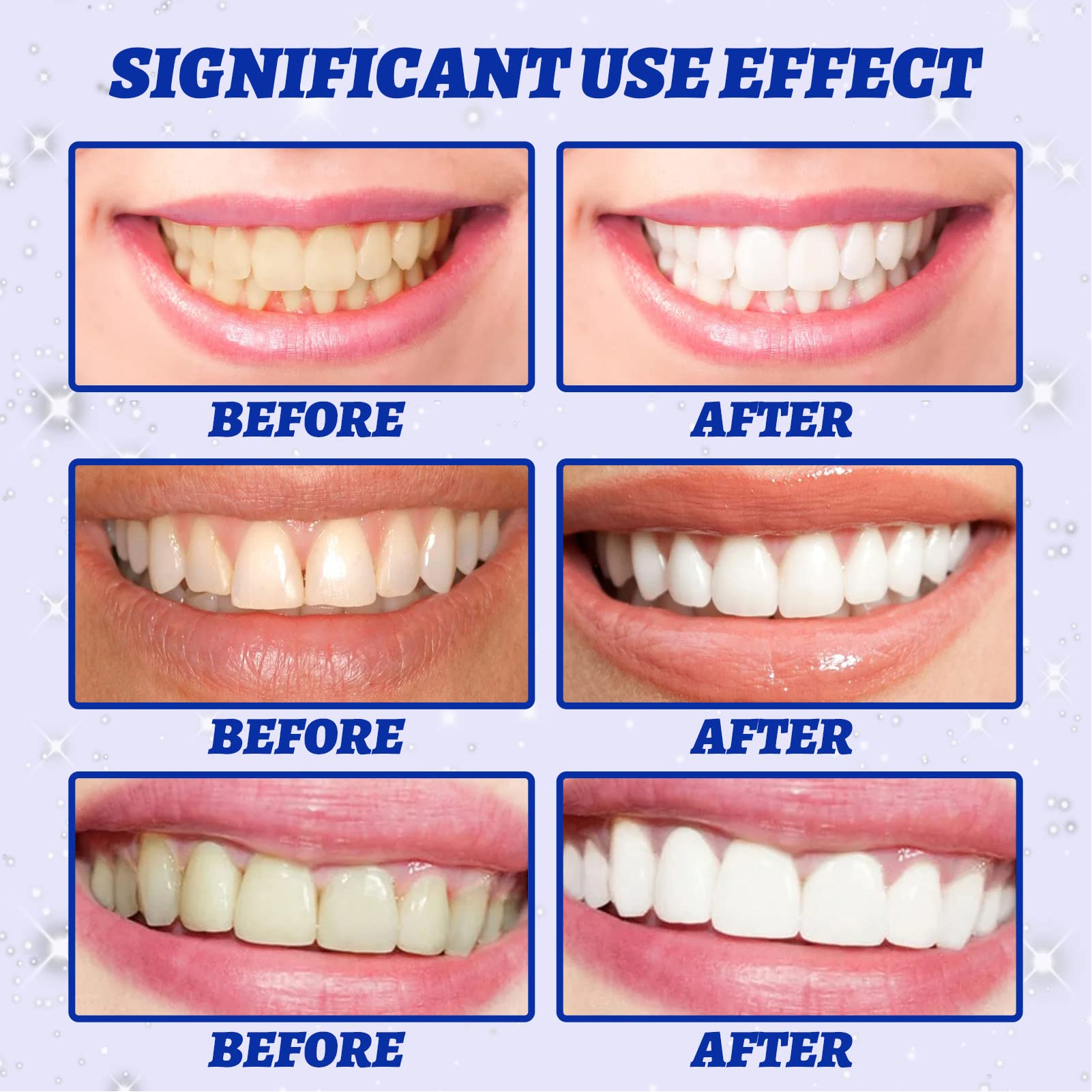 5D Teeth Whitening Strips, Sensitivity Free Whitening Strips, Dental Teeth Whitening Kit, 14 Whitener Strips, Remove Smoking, Coffee and Wine Stains, Whitening Without Any Harm