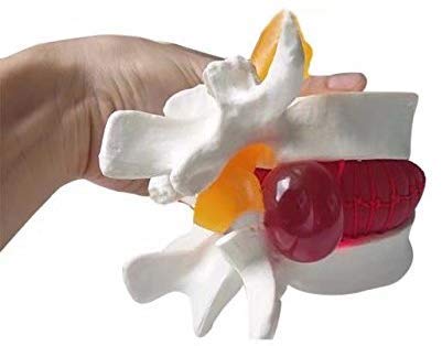 Doc.Royal Anatomical Human Lumbar Vertebrae Degenerative Lumbar Human Spine Model 1PCS