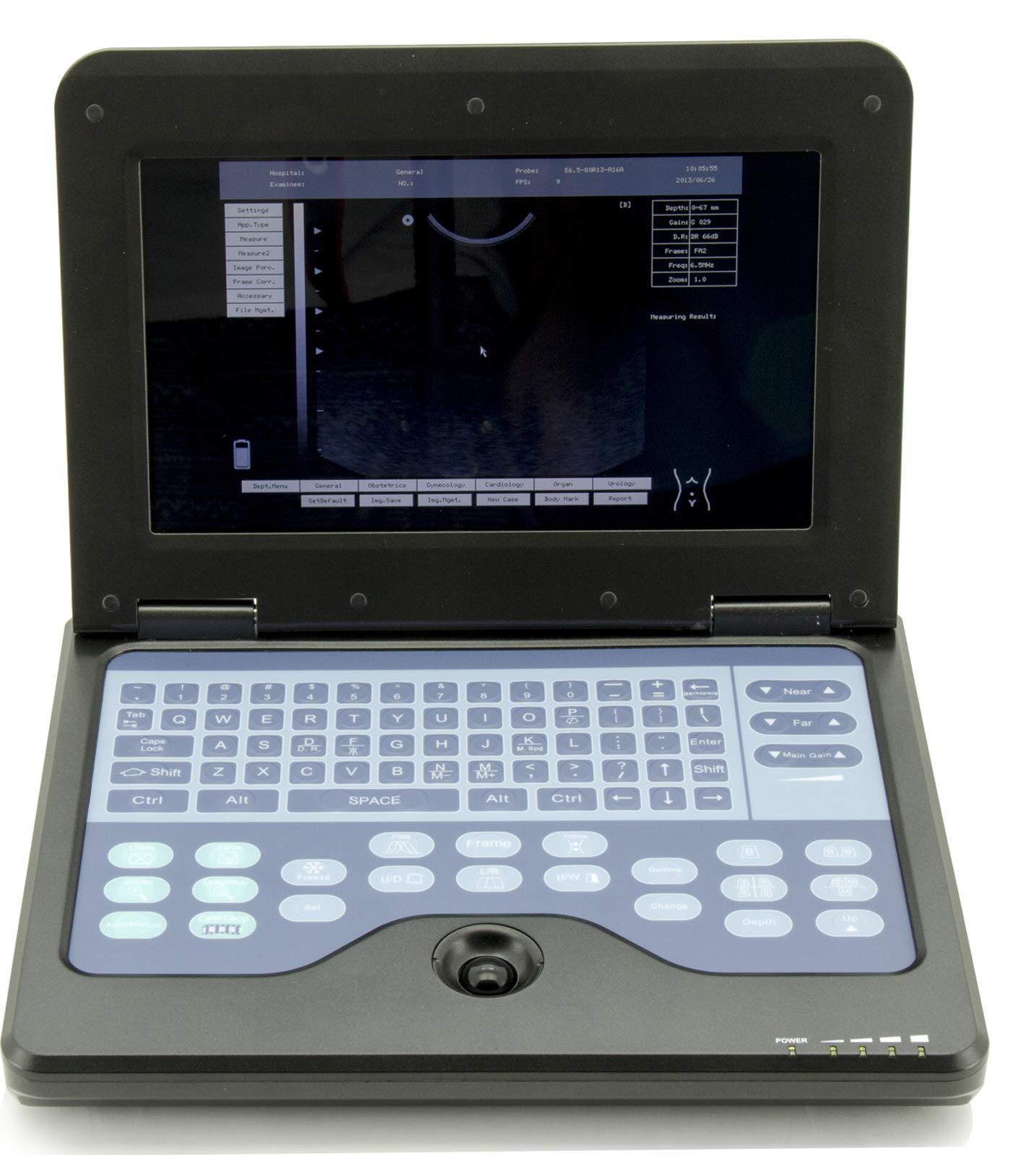 Portable Vet/Veterinary B-Ultrasound Scanner with 3.5Mhz Convex Probe for Horse,Goat,Cow,Sheep and Pig use
