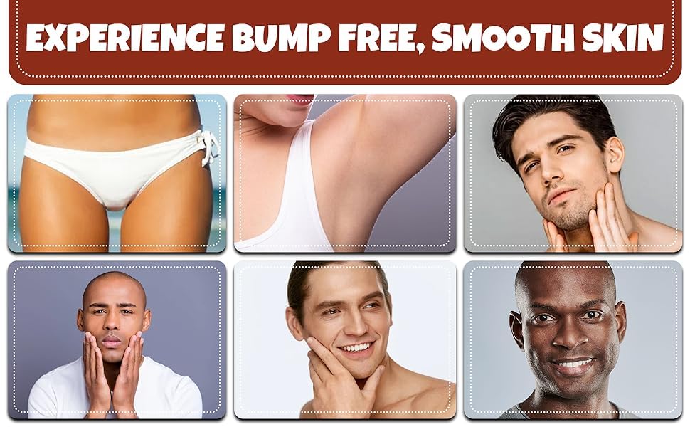 Bump Zapper Anti Bump Soothing Lotion