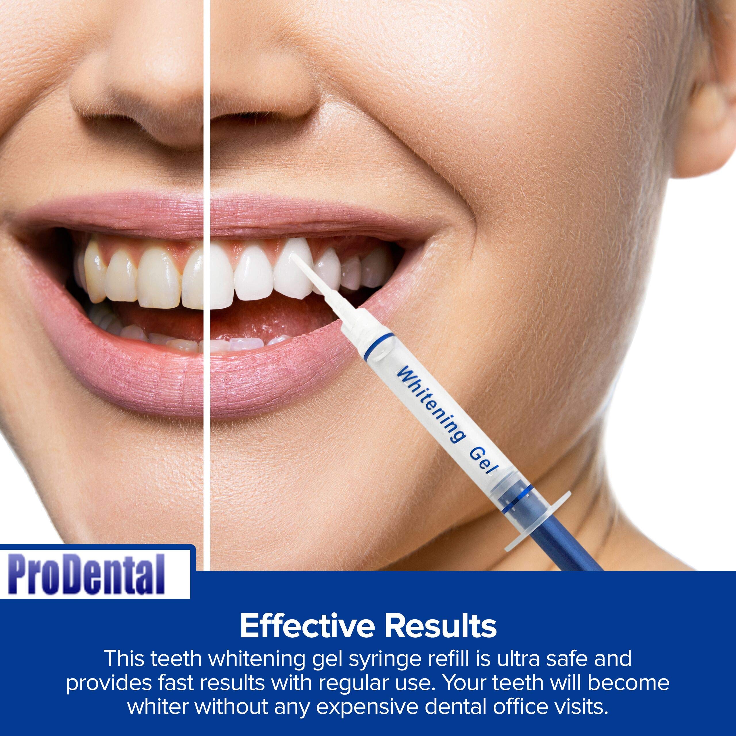 ProDental Teeth Whitening Gel Syringe Refill 8 Pack, 35% Carbamide Peroxide - 48 Treatments, Faster Results Than Tooth Whitening Strips - Pen - Powders and Toothpaste, Safe for Sensitive Teeth