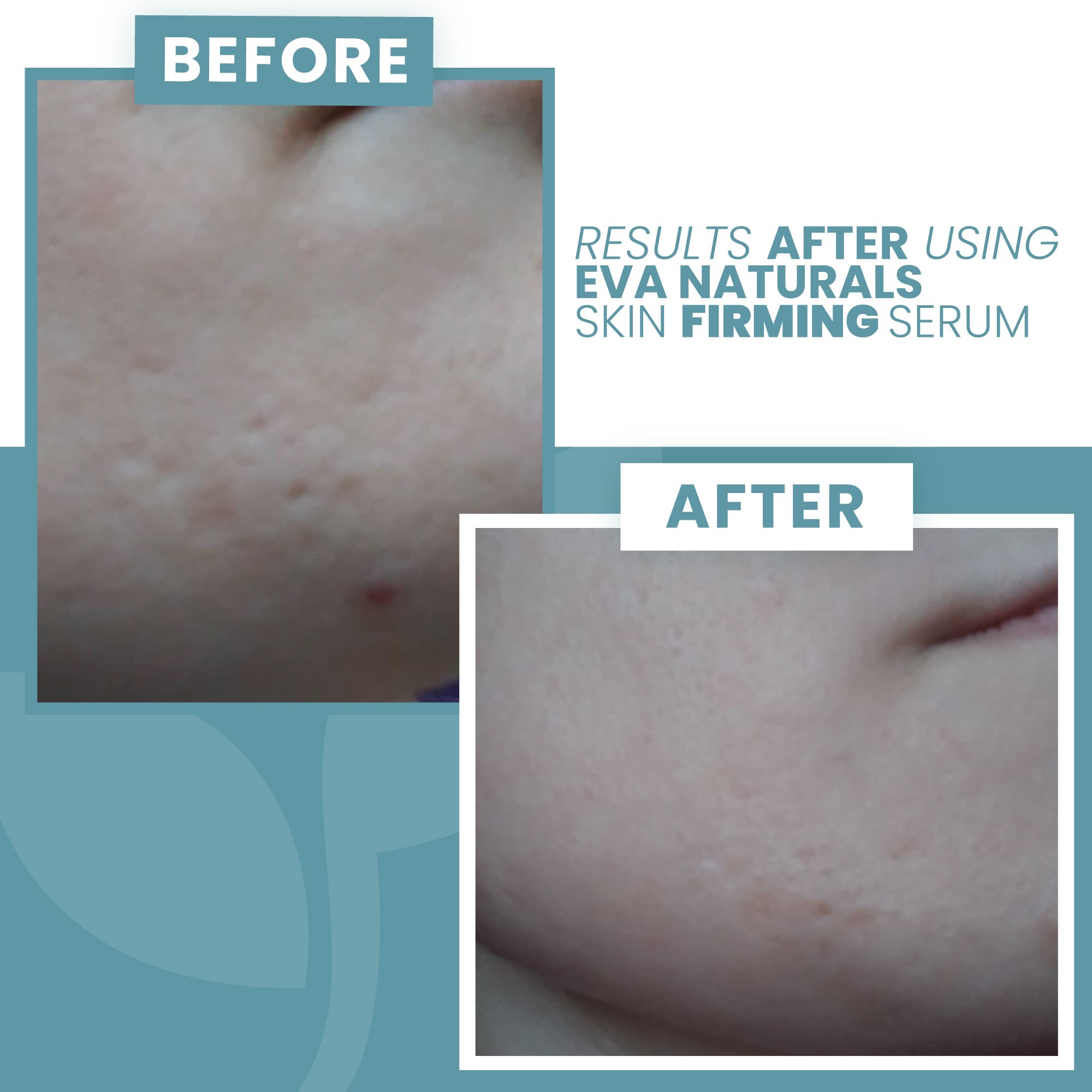 Eva Naturals Skin Firming Serum with Niacinamide and Hyaluronic Acid, 1 oz