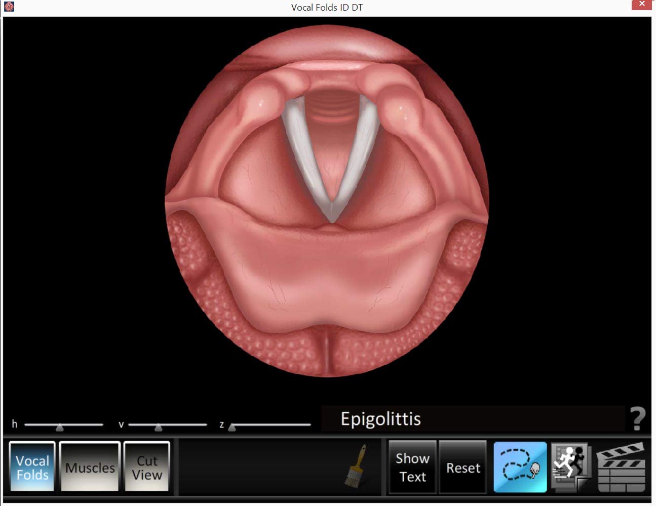Vocal Parts, Pharynx & Larynx Anatomical Chart with Software Larynx and Vocal Fold ID Speech Language Pathology, SLP, Singing
