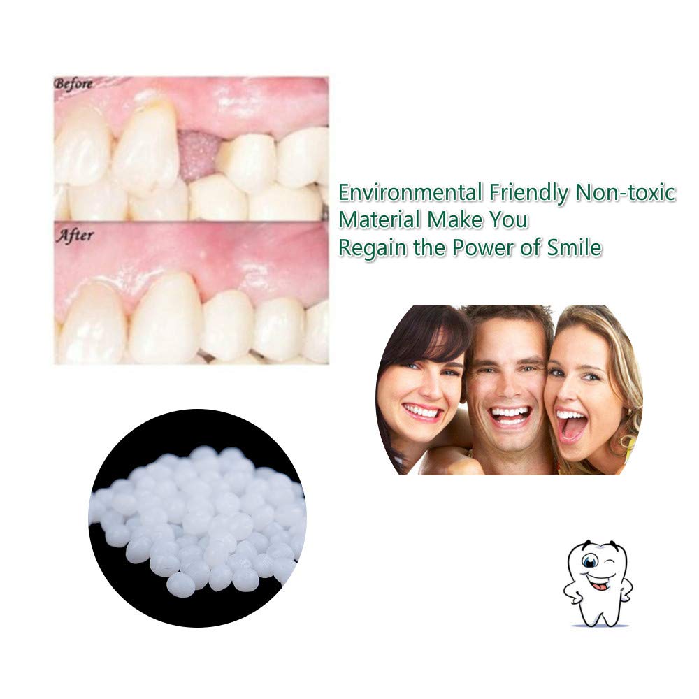 Multi-functional Temporary Tooth Repair Kit Moldable Thermal Fitting Beads for Snap On Instant and Confident Smile Denture Adhesive Fake Teeth Cosmetic Braces Veneer