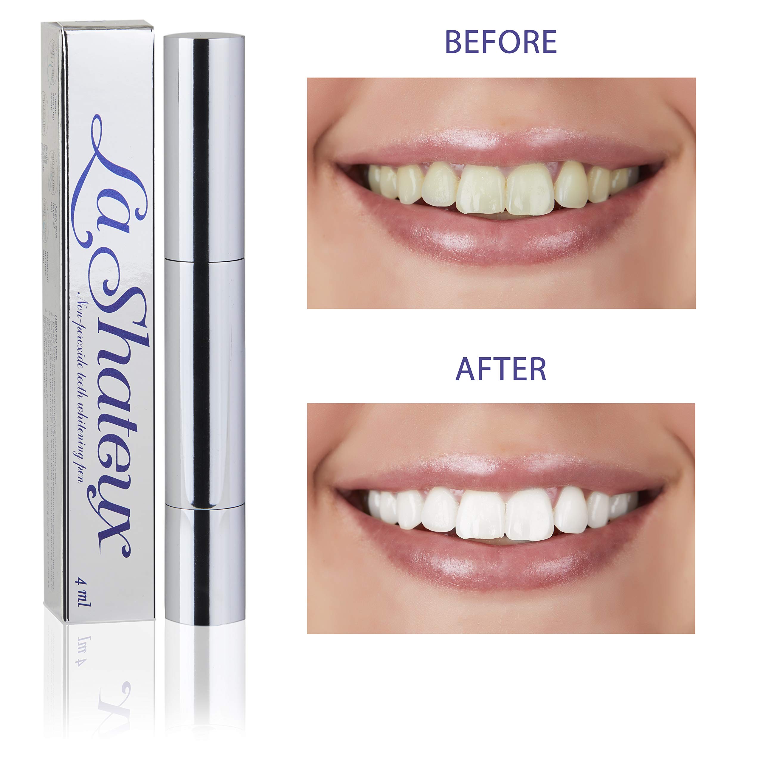 Premium Teeth Whitening Non Peroxide Formula Pen - 40+ Uses - No Sensitivity - Healthy Teeth Whitening - Snow White Teeth