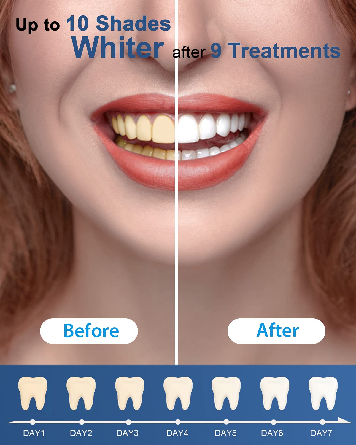 MySmile Teeth Whitening Gel Pen Refill Pack, 3 Non-Sensitive Teeth Whitening Pen, Deluxe Teeth Whitener Dental Grade Tooth Whitening Gel with Carbamide Peroxide for Home, 10 min Fast Result