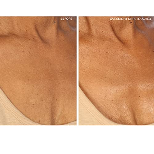SiO Beauty ChestLift - Chest Anti-Wrinkle Pad 4 Weeks Supply - Overnight Smoothing Silicone Pad For Cleavage & Decollete Skin