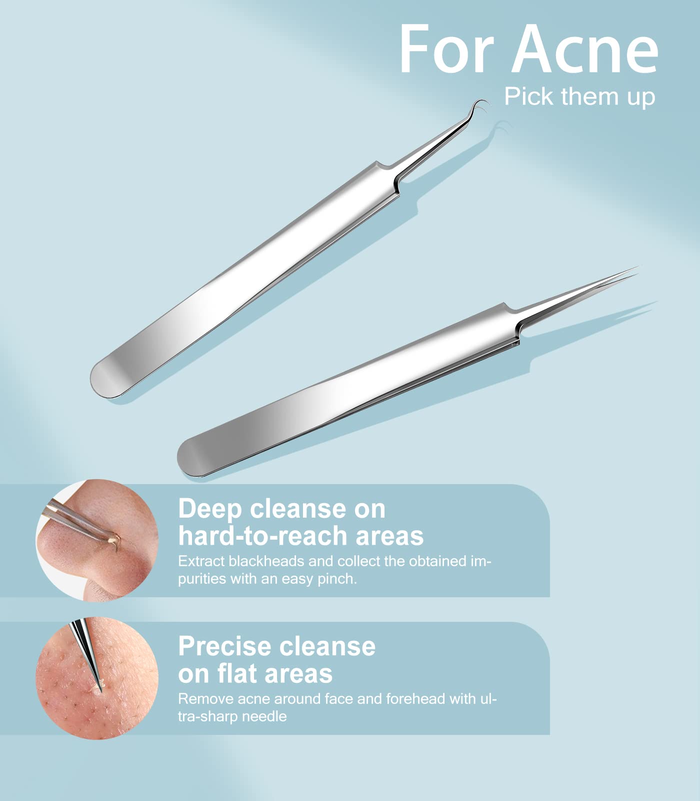 Pimple Popper Tool Kit, Upmore 6PCS Blackhead Remover Professional Stainless Acne Blemish Comedone Extractor Removal Tools with Metal Case and Tweezers for Whitehead Acne on Nose Face