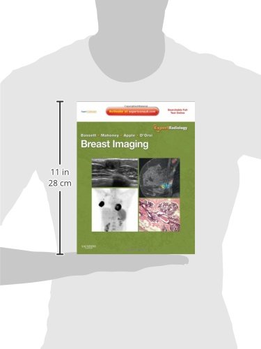 Breast Imaging: Expert Radiology Series