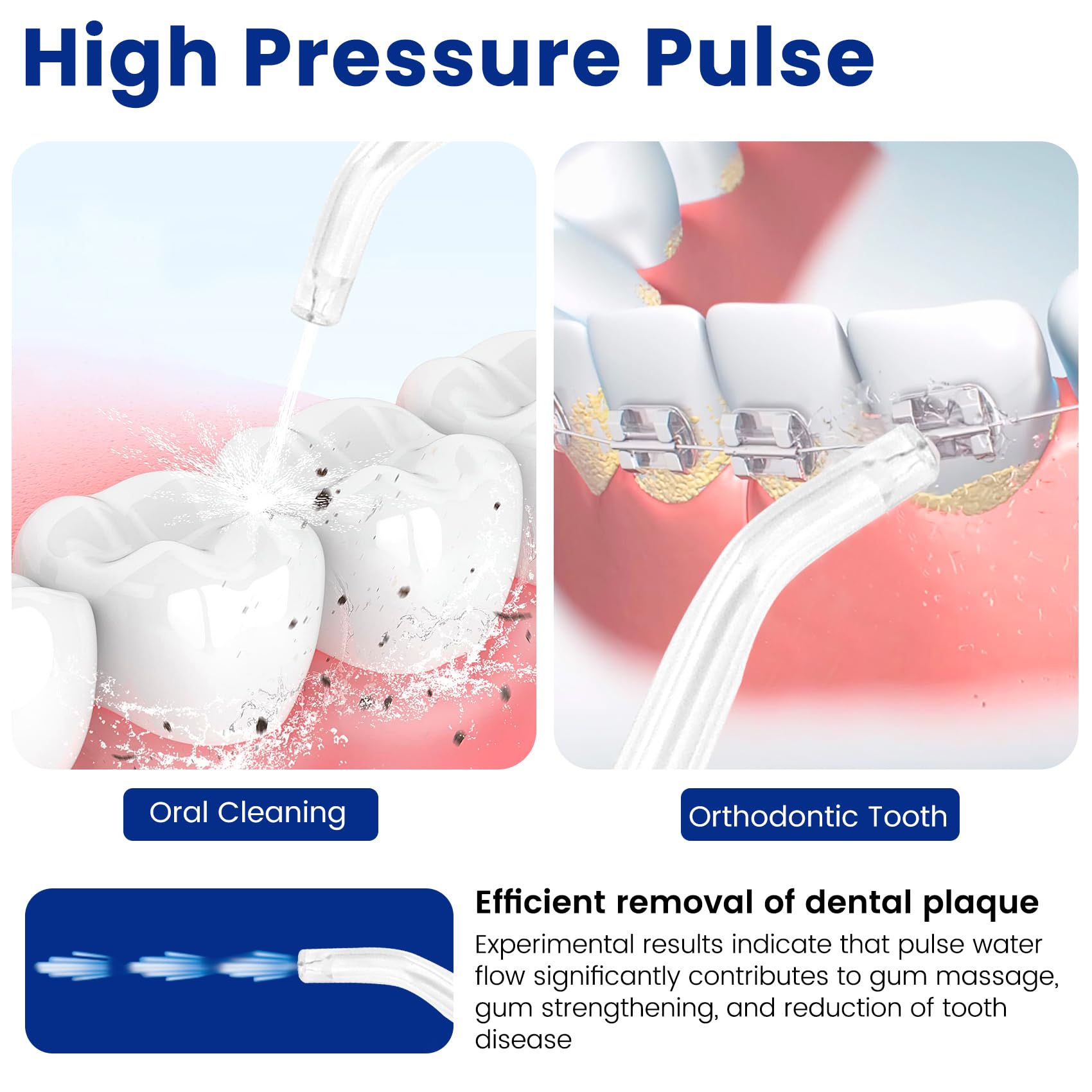 Dental Water Flosser Teeth Cleaner - Zerhunt High Frequency Pulsed Water Flosser Electric Oral Irrigator with 5 Interchangeable Nozzles for Braces, Implants, Bridges, 600ML Large Capacity Black