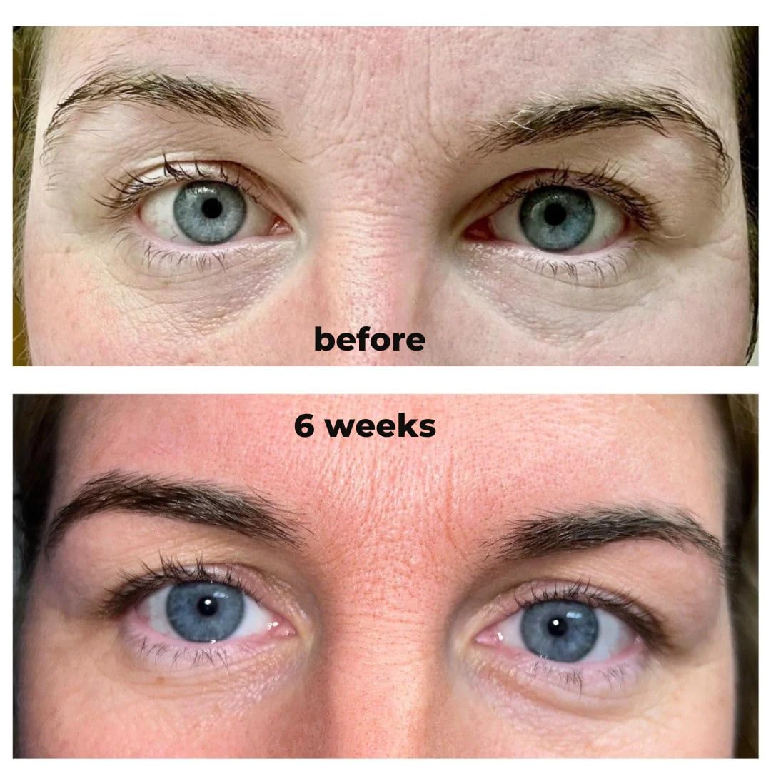 nuorganic Brow Growth Serum - Stronger + Thicker + Longer Eyebrows in 30 Days - Patented PhytoCellular Science - Vegan + Cruelty Free