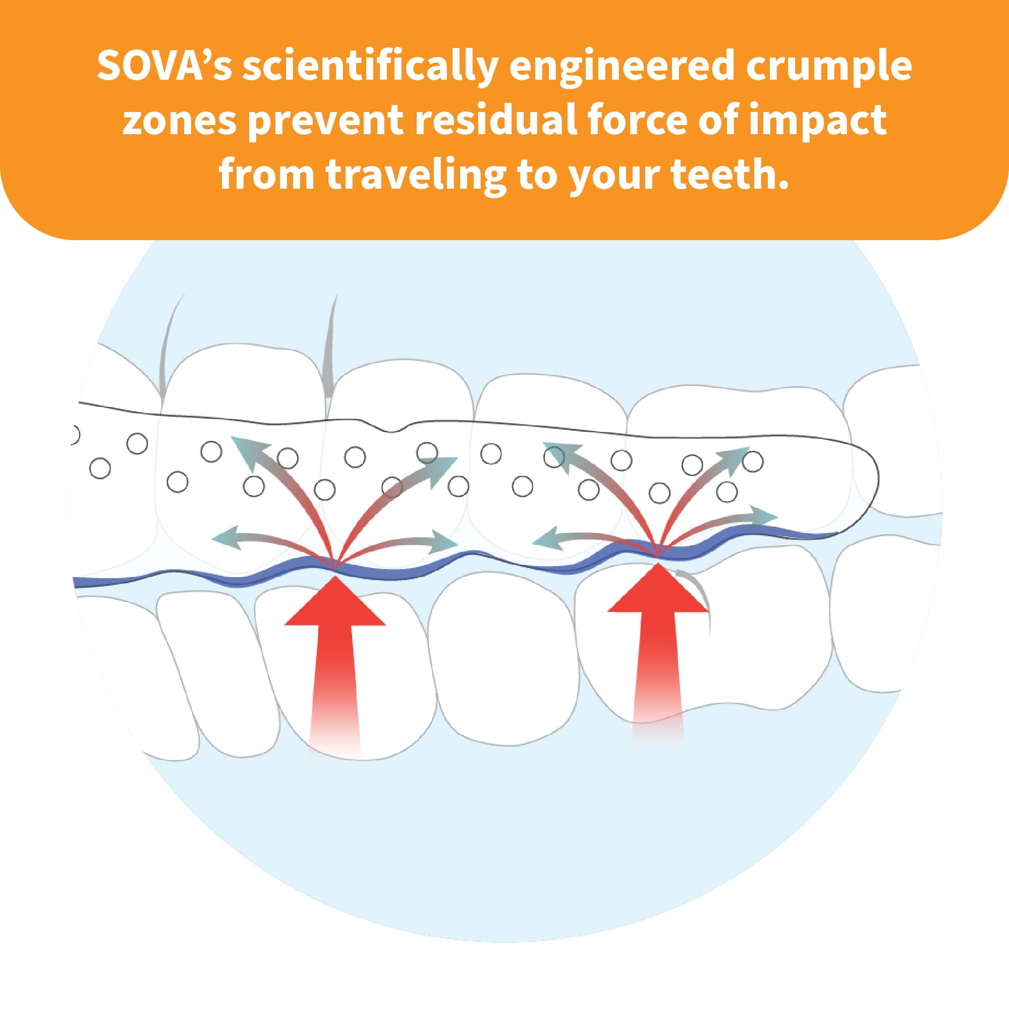 SOVA Junior Night Guard, Spring Green - 1.6mm Thin - Custom-Molded Fit - Protects Against Nighttime Teeth Grinding & Clenching - FSA/HSA Eligible - Odor & Taste Free - Remoldable Up to 20 Times