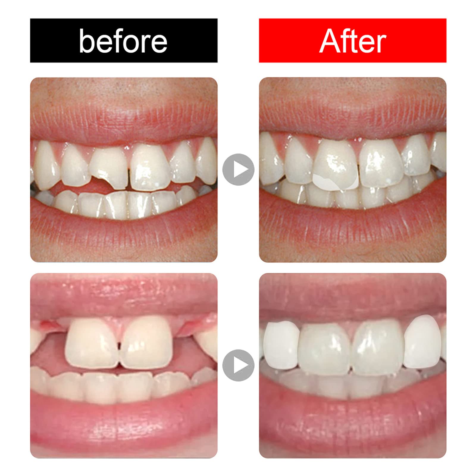 56 Pcs False Teeth Dental Complete Acrylic Resin Denture Teeth, 2 Set Whole Teeth Synthetic Polymer Denture Tooth, 23 Shade A3 Upper + Lower Dental Materials for Replacement, DIY, or Halloween