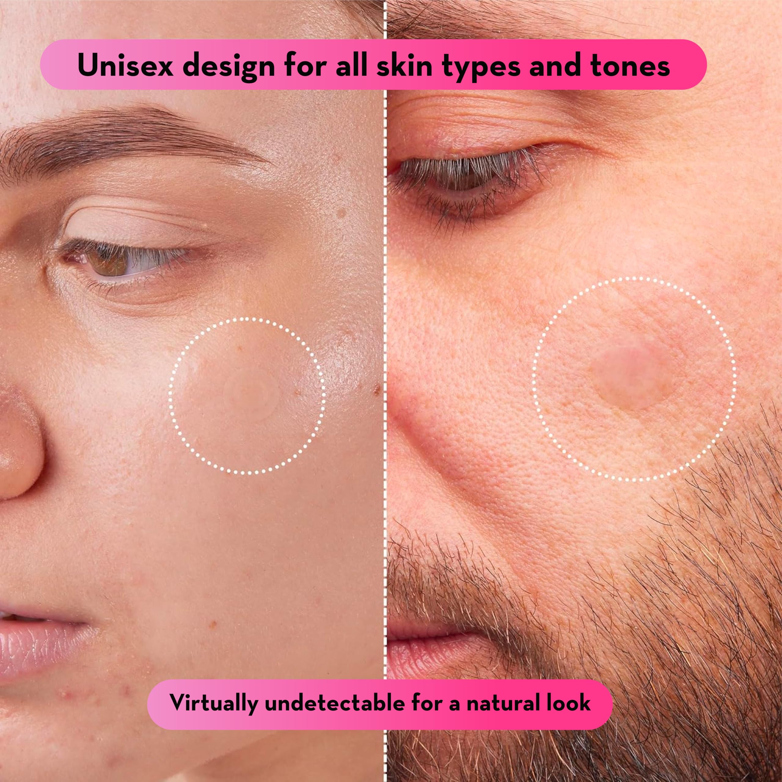 LE GUSHE Pimple Patches for Face (132 dots) - Hydrocolloid Acne Patch for Zits and Blemishes - Invisible Blemish Patches for Face - Spot Cover Stickers
