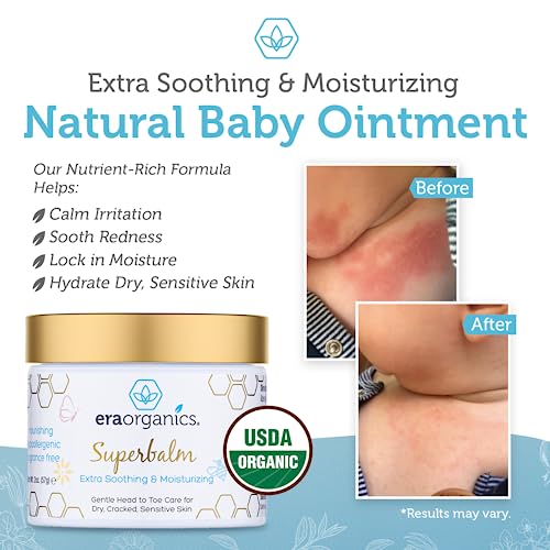 Era Organics Healing Ointment for Babies - USDA Certified Organic Natural Gentle Moisturizer for Sensitive Skin Prone To Baby Eczema, Cradle Cap (Infant Seborrheic Dermatitis), Rashes, Hives & More