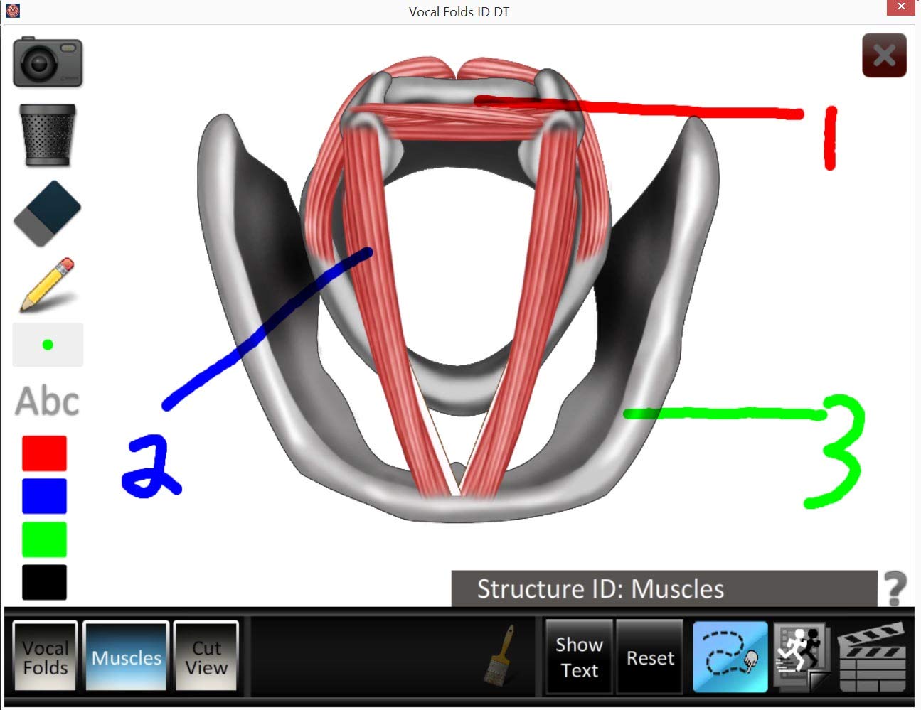 Vocal Parts, Pharynx & Larynx Anatomical Chart with Software Larynx and Vocal Fold ID Speech Language Pathology, SLP, Singing