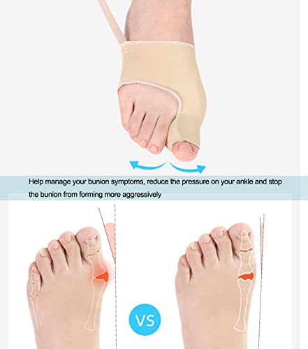 Bunion Corrector, Bunion Pain Relief Splint, Big Toe Straightener Pain Relief for Women & Men, Day Night Support