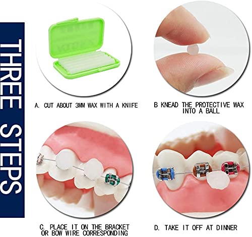 RZJZGZ Dental Oral Care Orthodontics Wax with Fruit Smell for Brace Wearers Flavored Gum Protection (3Pack)