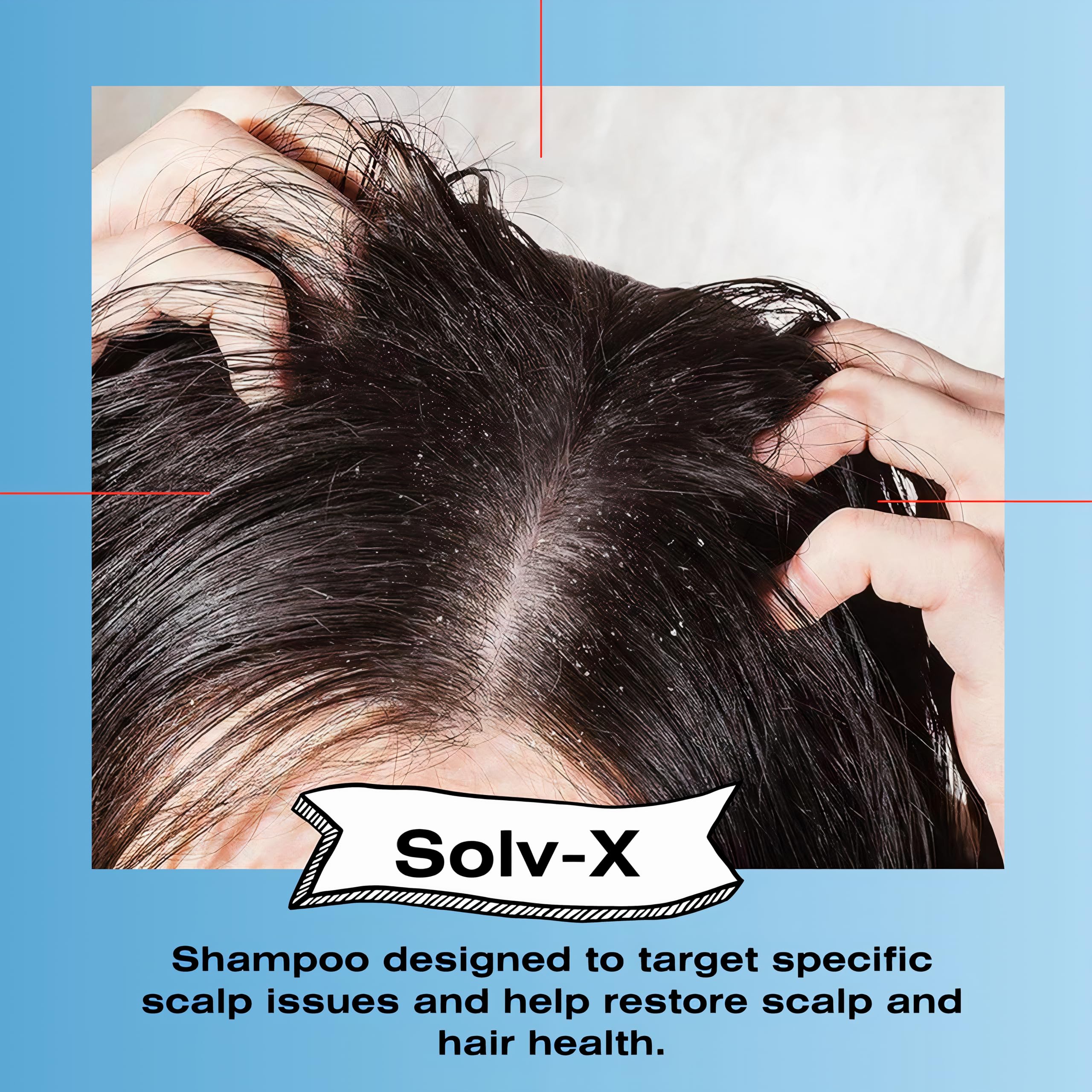 Mediceuticals Solv-X Shampoo - For Oily Hair and Scalp - Scalp Acne Shampoo for Men, Women and Teens 8.45 oz (250 ml)