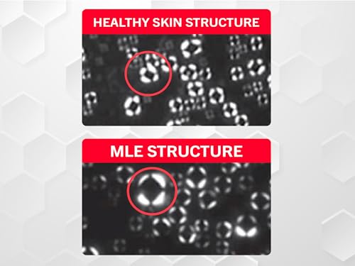 ATOPALM Intensive Moisturizing Cream for Dry & Sensitive Skin, Face Moisturizer, Replenishes Hydration, Paraben-Free, K-Beauty, skin barrier ceramide cream, 3.4 Fl Oz, 100ml (3.4 Fl Oz)