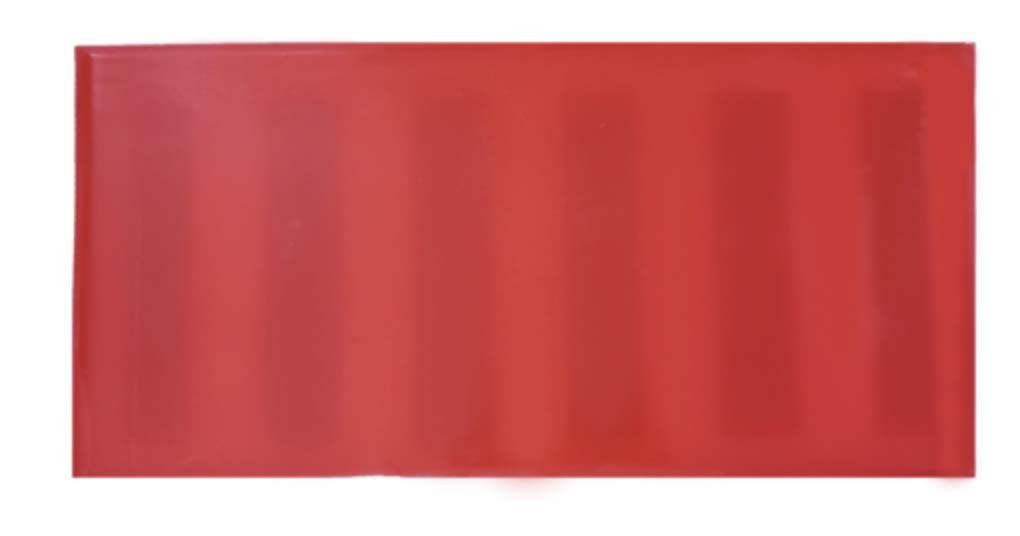 Chest Tube Replacement Ribs (Adult)