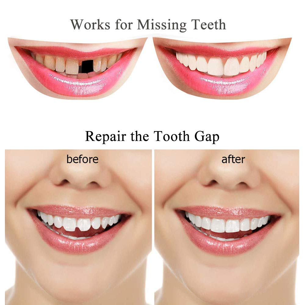 Tooth Repair Kit-Thermal Beads for Filling Fix The Missing and Broken Tooth or Adhesive The Denture Fake Teeth