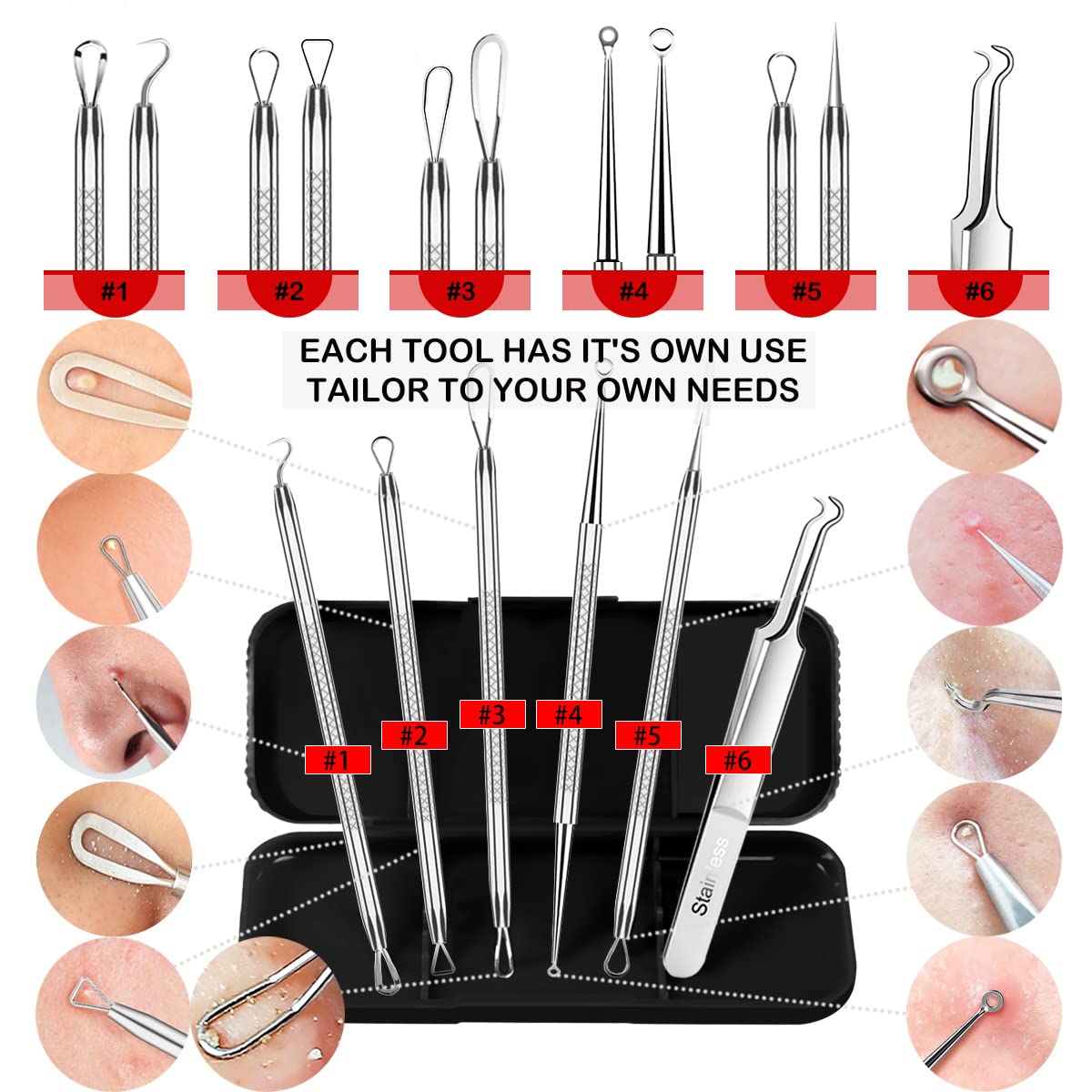 Blackhead Extractor, 6 Pack Pimple Popper Tool Kit for Removing Blackhead, Whitehead, Pimple, Acne, Zit, Comdone, Pores, Fat Granules on Nose, Face - with Organized Case