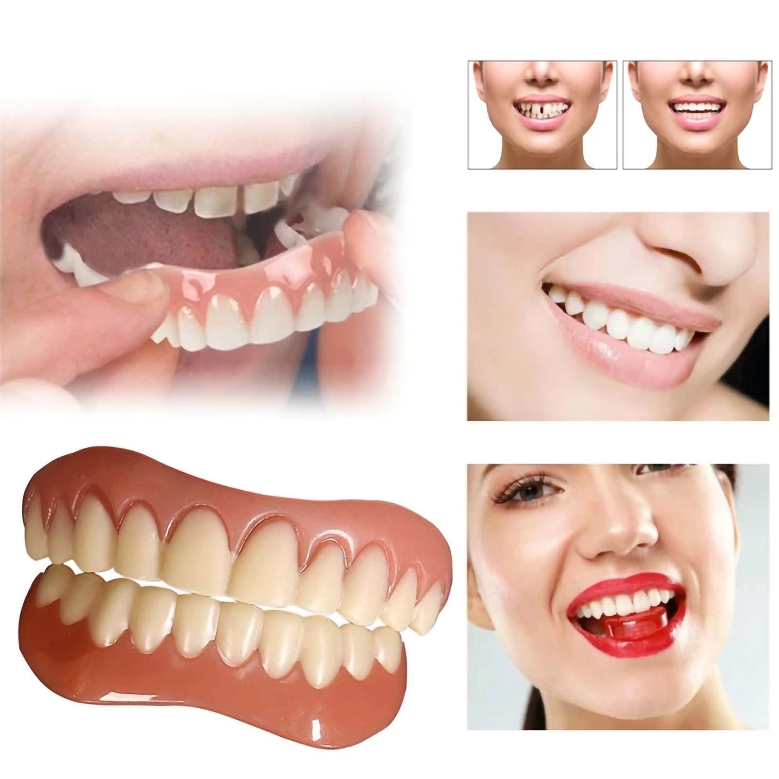 CHNLML Fake Teeth, Cosmetic Denture Veneers for Upper and Lower Jaw, Dental Veneers for Temporary Teeth Restoration, Nature and Comfortable, Protect Your Teeth - 2 Pcs