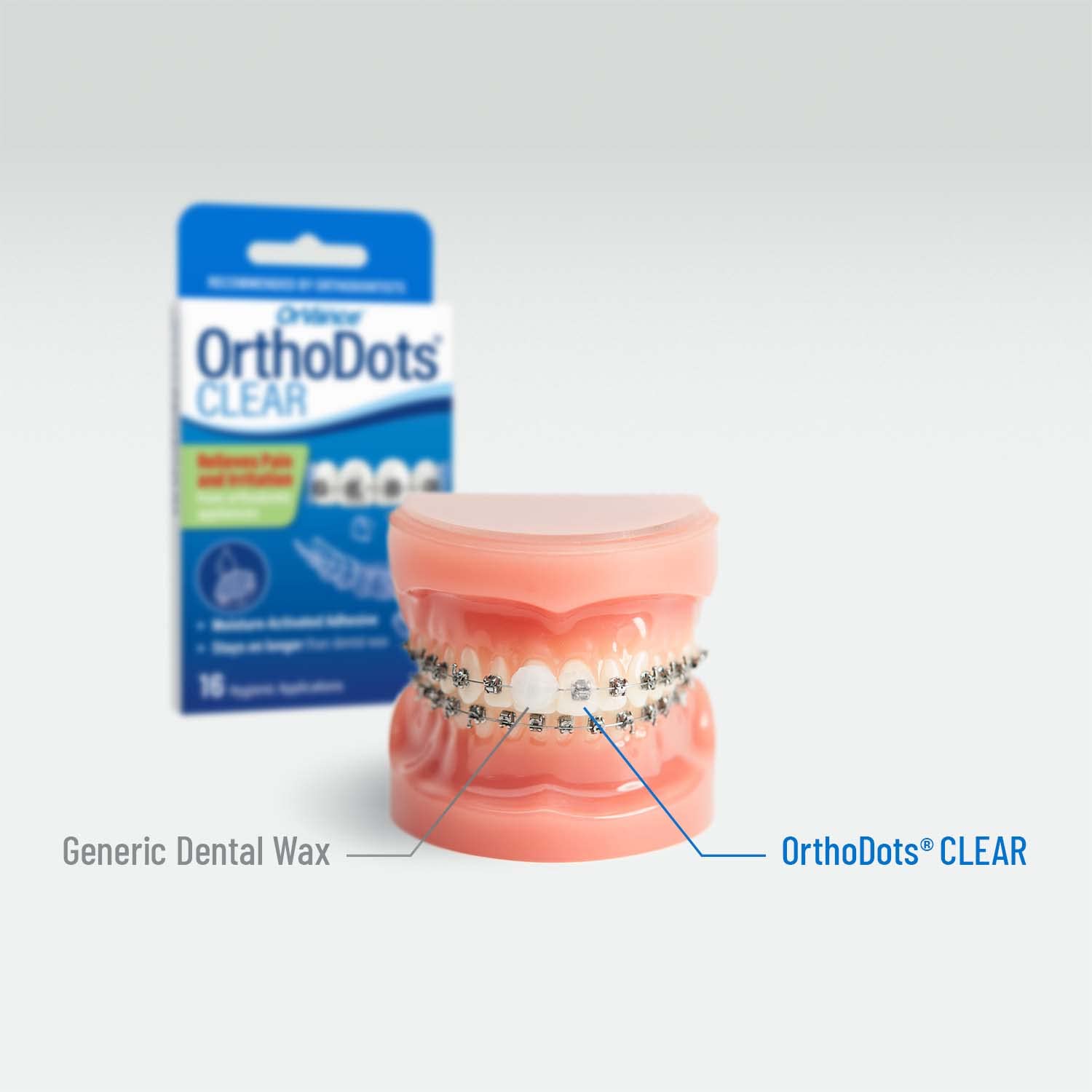 OrthoDots CLEAR β Moisture Activated Braces Wax Alternative for Pain Caused by Braces, Clear Aligner Trays, and Other Orthodontic Appliances. OrthoDots Stick Better and Stay on Longer than Dental Wax.